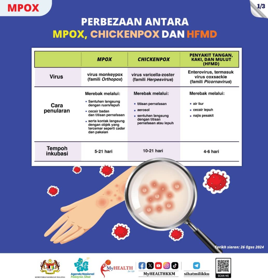 Perbezaan penyakit MPOX (monkey pox), Chickenpox dan HFMD - Pembekal ...